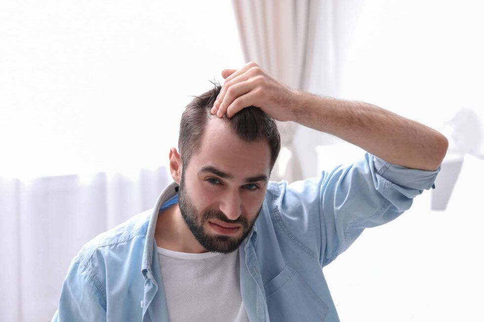 Combating a Receding Hairline | Causes, Symptoms, and Treatments