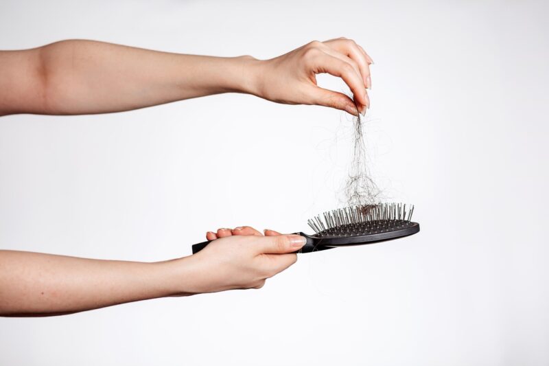Top Hair Shedding Causes and Best Treatment Options - Detailed Guide