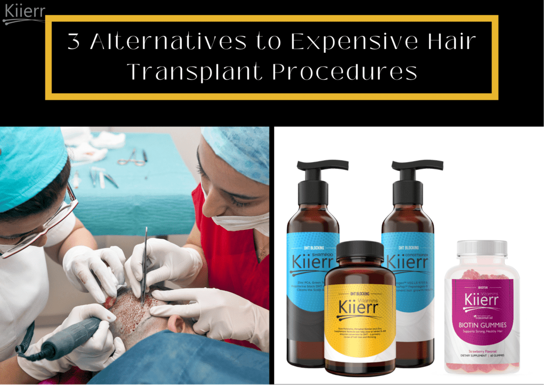 3 Alternatives to Expensive Hair Transplant Procedures - Kiierr Laser ...
