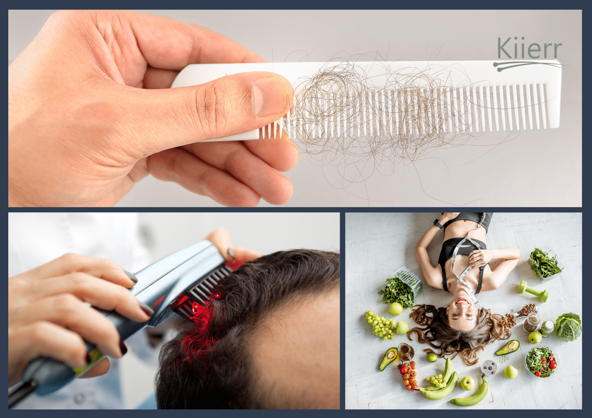 Hair Loss Can Lead to Extreme Mental Stress—Here’s What You Can Do to ...