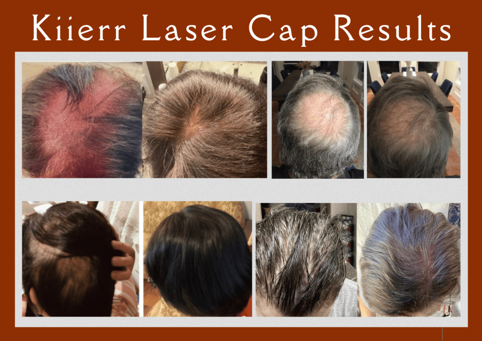 What is a Laser Cap? | Kiierr Laser Cap