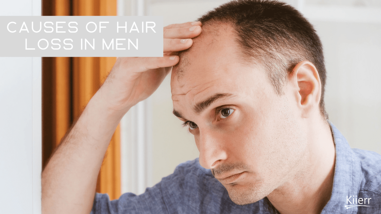 Hair Loss in Men: Why it Happens and What You Can Do About It - Kiierr ...