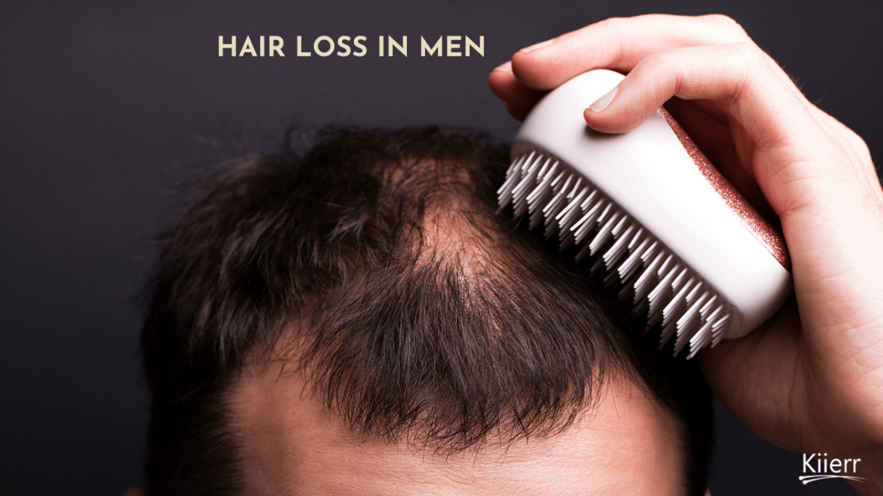 Hair Loss in Men: Why it Happens and What You Can Do About It - Kiierr ...