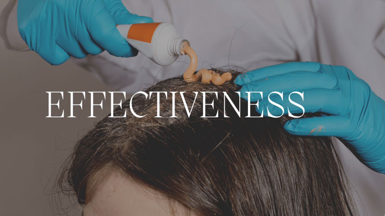 Exploring Hair Loss Treatments: Oral vs. Topical Options - Kiierr Laser ...