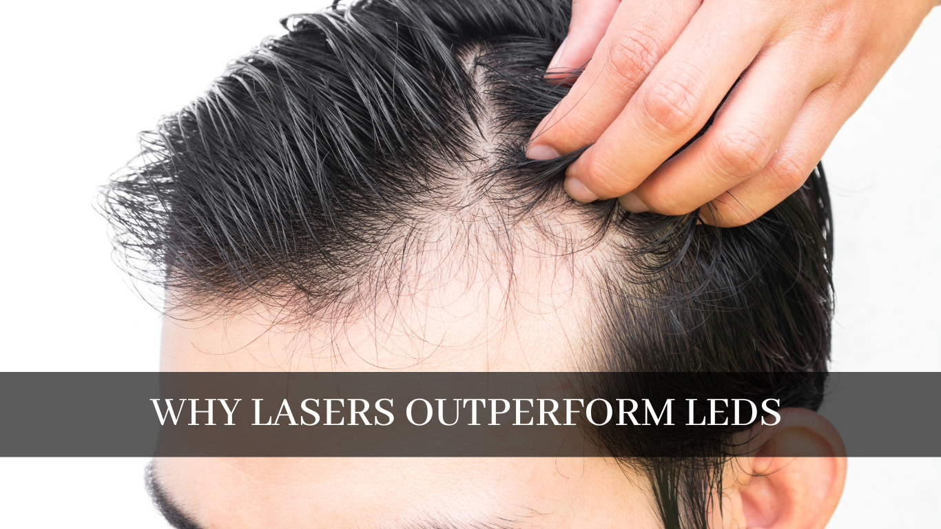 The Laser Advantage: Why Lasers Outperform LEDs for Effective Hair ...