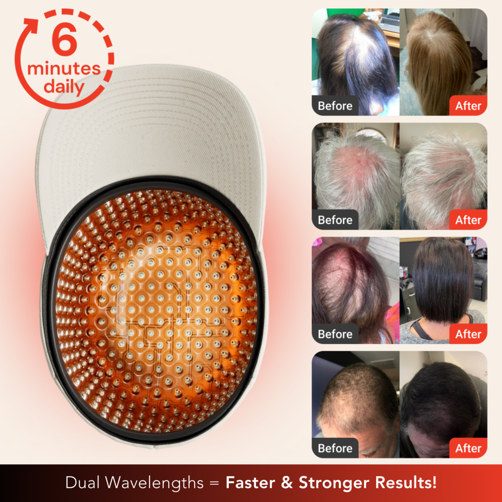 312 MD DualWave Laser Cap - Kiierr Laser Hair Caps - Hair Growth Experts