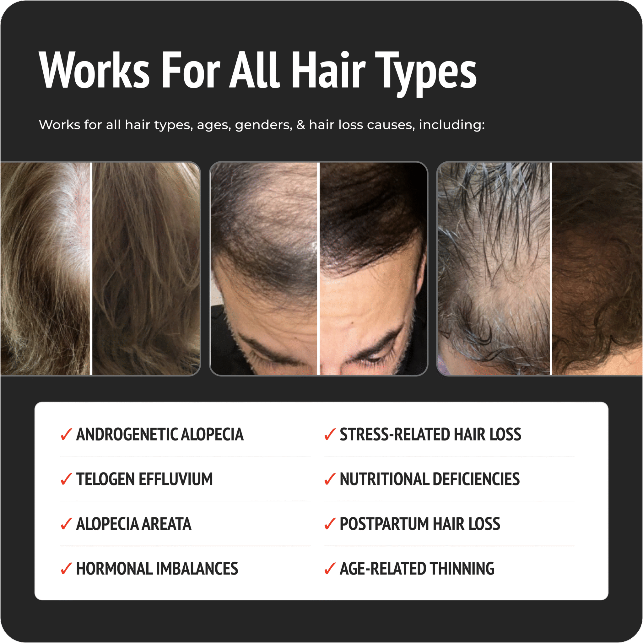 Grow Your Hair with the Kiierr Laser Cap Hair Growth System - Kiierr ...